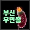 복부초음파로 확인된 부신종양부신우연종 네이버 블로그